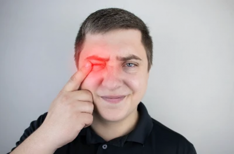 Leucoma corneal qué es, causas, síntomas y tratamiento